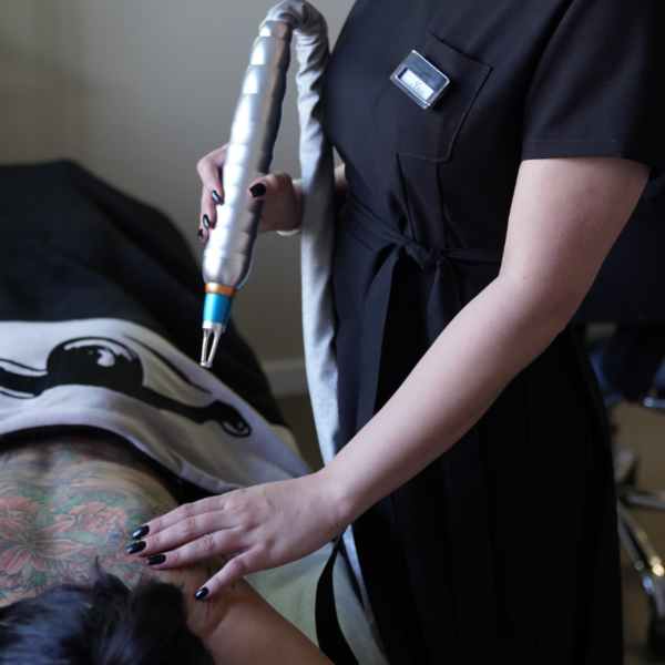 Tattoo Removal – Kanani Beauty and Aesthetics